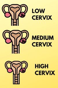 Low Cervix Menstrual Cups